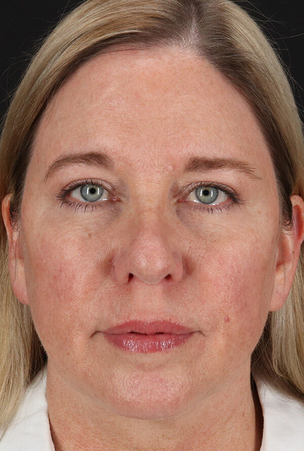 Explore Our Gallery of Cosmetic and Reconstructive Transformations